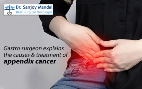 Gastro Surgeon Explains Causes & Treatment of Appendix Cancer